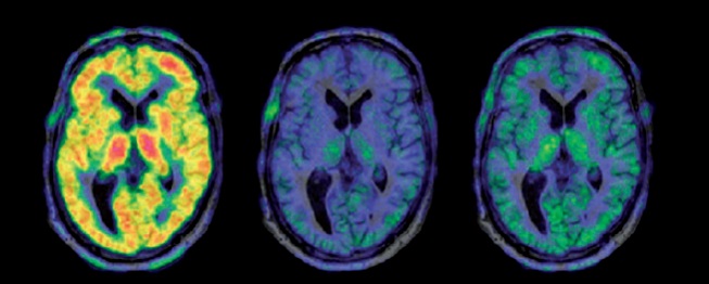 It’s not just about the neurones - MND Research Blog