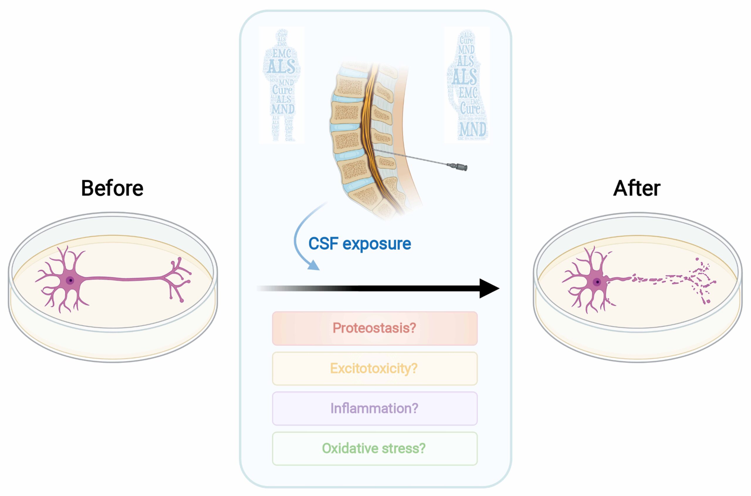 Toxicity of cerebrospinal fluid in ALS/MND - MND Research Blog